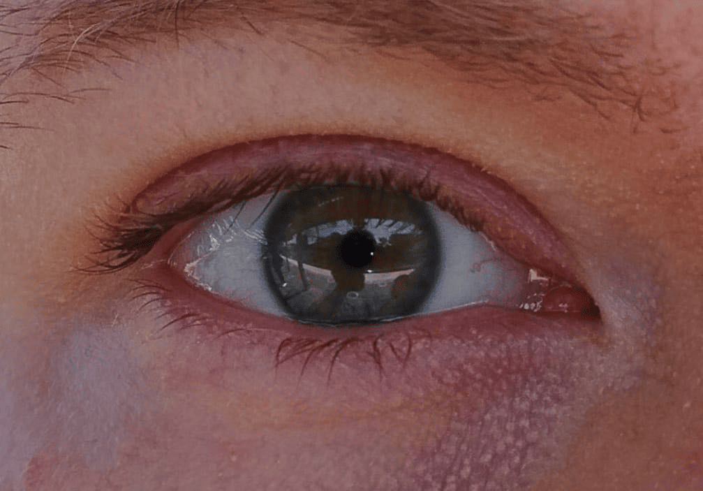 Témoignages - Association SOS Syndrome de L'Oeil Sec